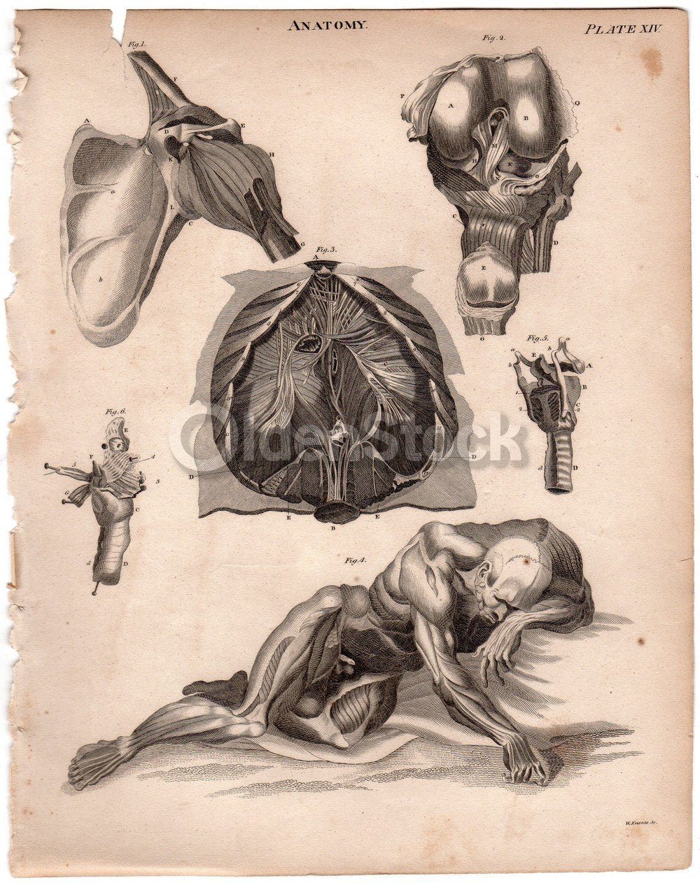 Male Penis Groin Testicles Medical Anatomy Drawing Antique Graphic Eng ...